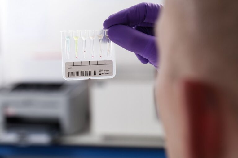 Red cell serology - Essange Reagents